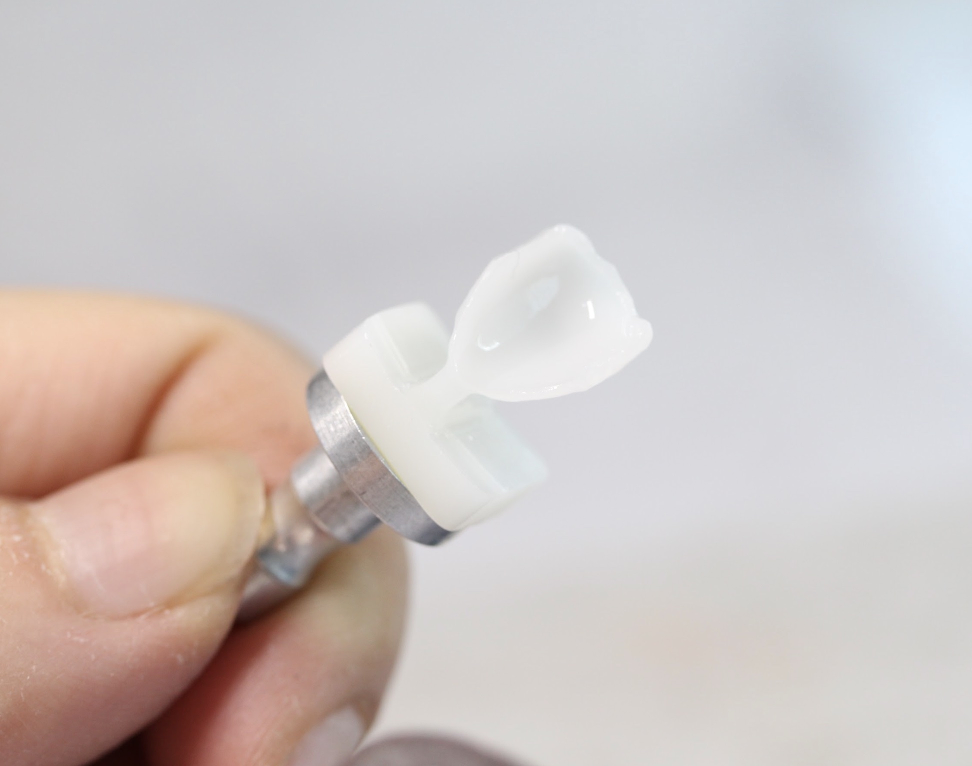 A Comprehensive Overview | MINISH Veneers for Dental Practices