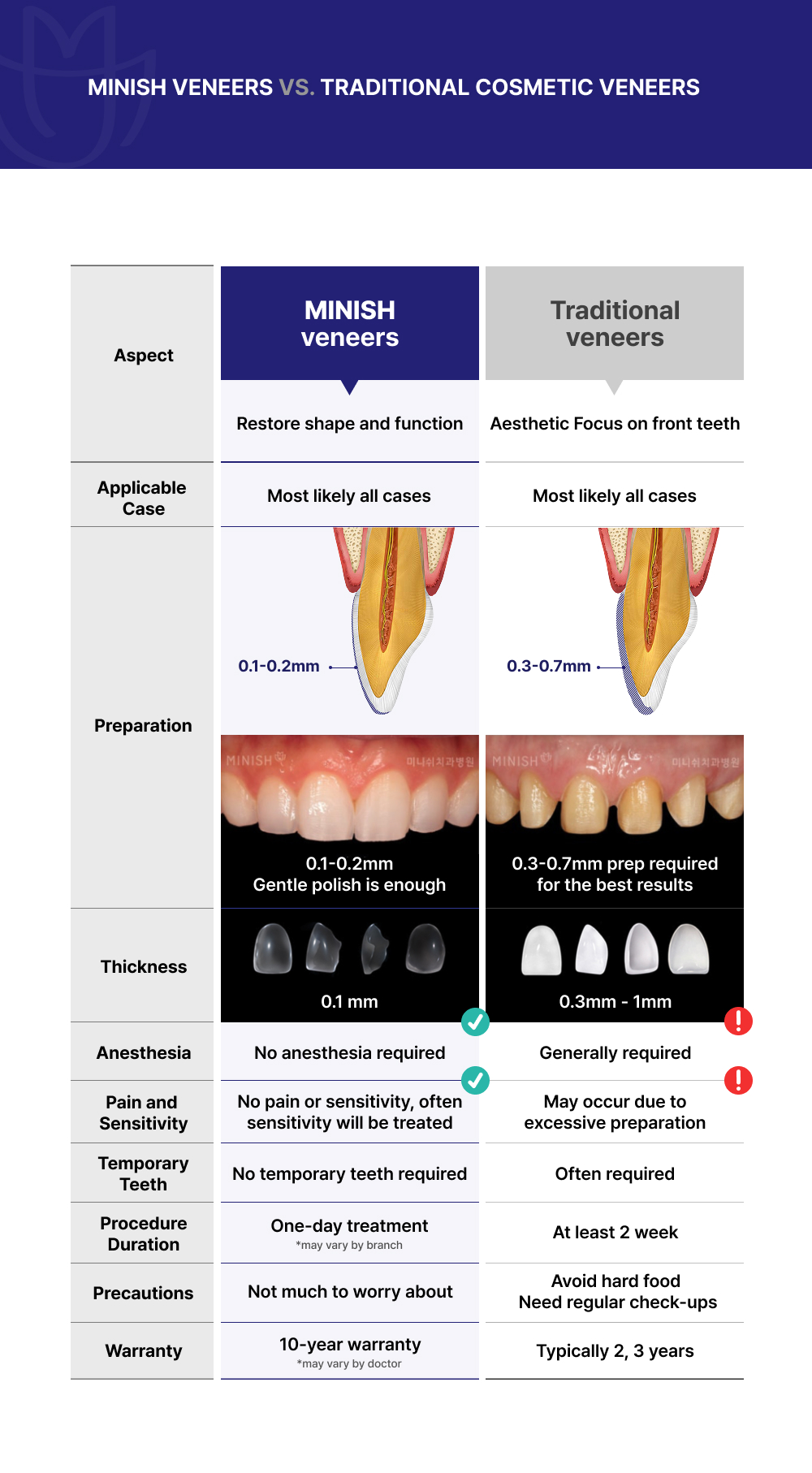 A Comprehensive Overview | MINISH Veneers for Dental Practices